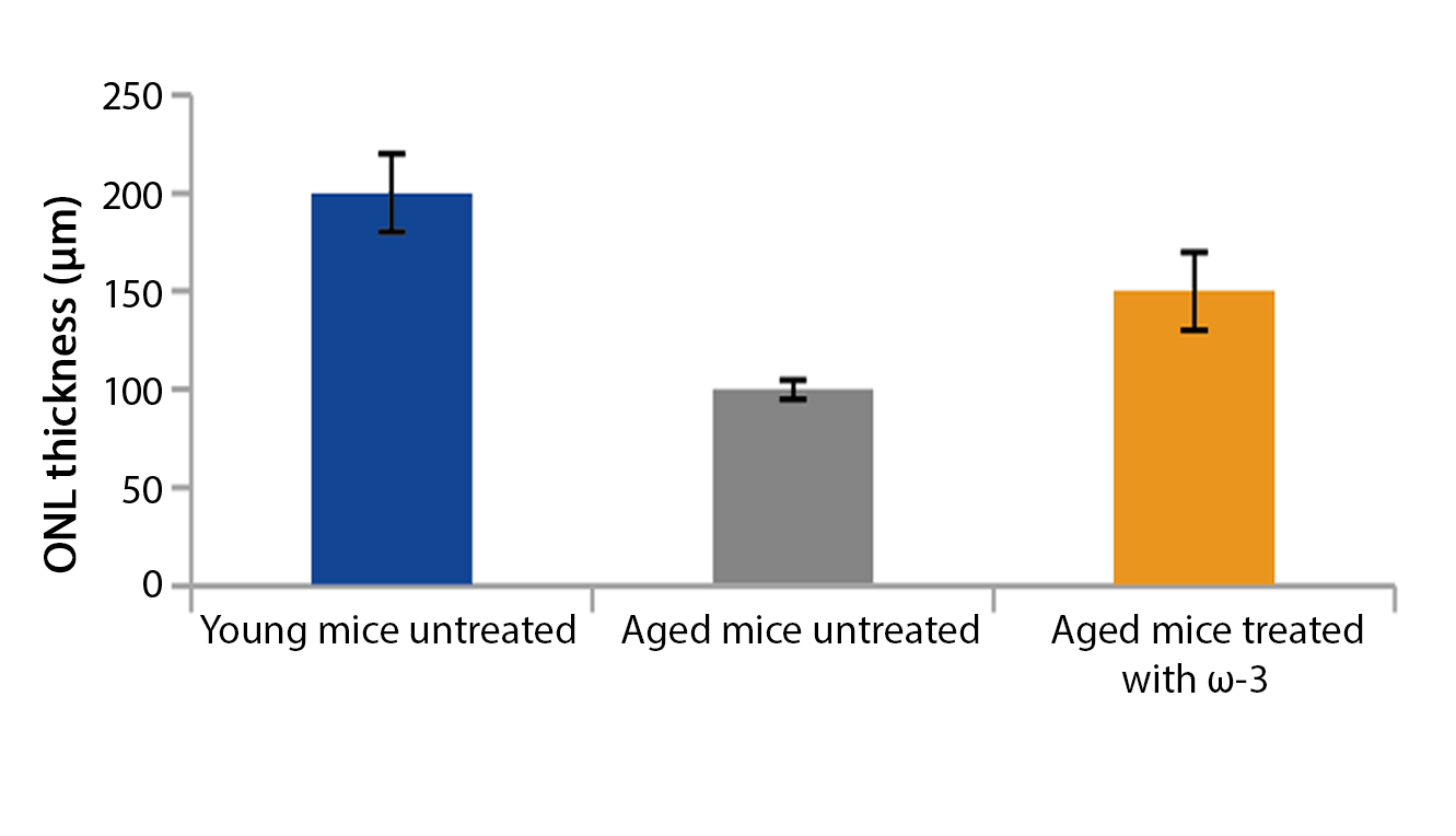 Aging Retina - eyetas
